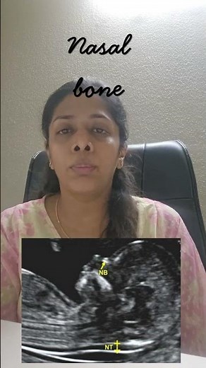 What is NT scan.? #fetalmedicine #pregnancycare