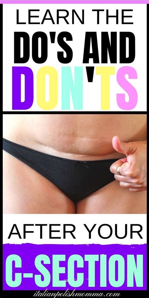 The Do S And Don Ts After A C Section Artofit