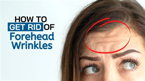 How To Get Rid Of Forehead Wrinkles Fast Remedium Korea