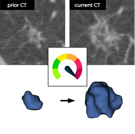 Deep Learning To Estimate Pulmonary Nodule Malignancy Risk Using A