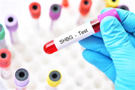 do serum sex hormone binding globulin testosterone levels