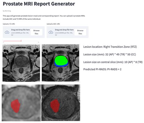 Diagnostics Free Full Text Joint Cancer Segmentation And Pi Rads