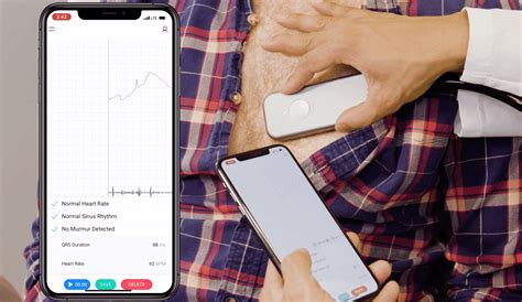 Fda Clears Ekos Afib And Heart Murmur Detection Algorithms