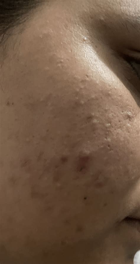Skin Care Routine Advice R Indianskincareaddicts