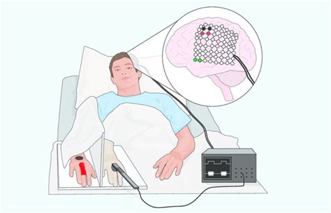 Tms Vr For Sensory Motor Skill Recovery After Stroke Applysci