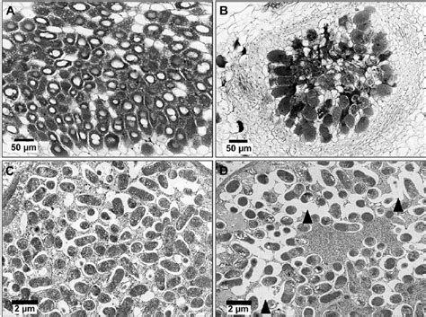 Nodules And Infected Cell Structures Of The Wild Type Miyakojima And