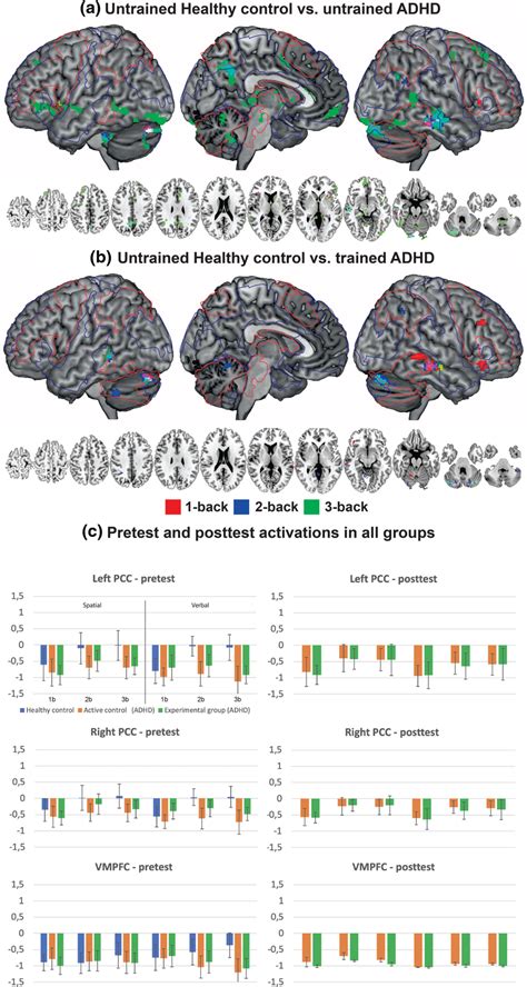 A Group Differences Healthy Controls Vs Participants With Adhd In