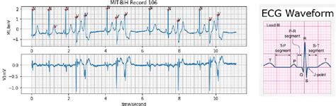 Figure 1 From A Self Contained Stft Cnn For Ecg Classification And