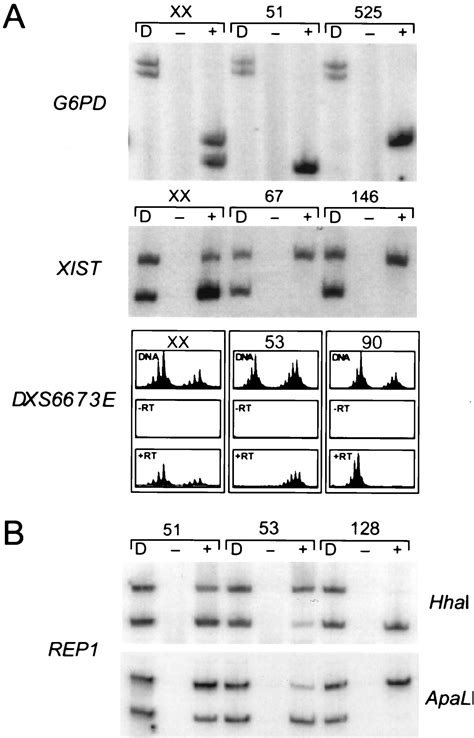 Heterogeneous Gene Expression From The Inactive X Chromosome An X