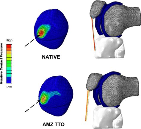 Preliminary Sample Finite Element Analysis Fea Model Demonstrating
