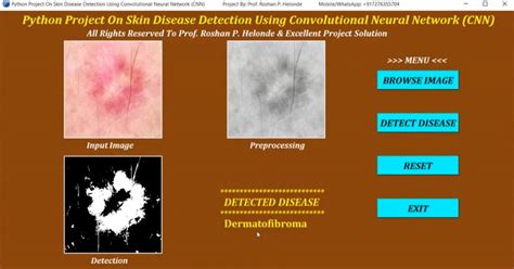 Skin Disease Detection Using Convolutional Deep Learning Neural Network