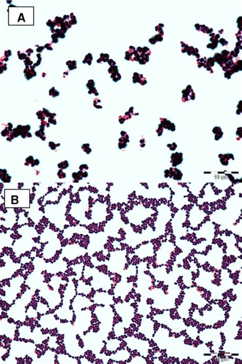 Enterococcus Faecalis Gram Stain Morphology