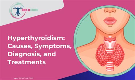 Hyperthyroidism Causes Symptoms Diagnosis And Treatment Ensocure