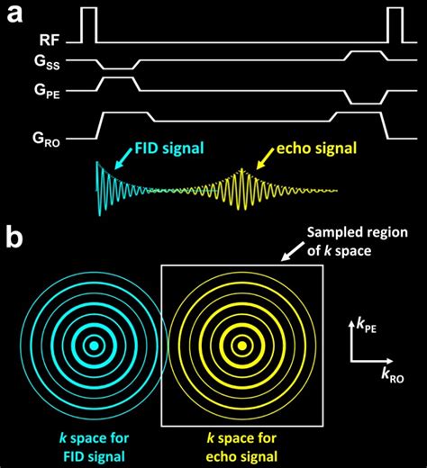 Optimized Three‐dimensional Fast‐spin‐echo Mri Mugler 2014
