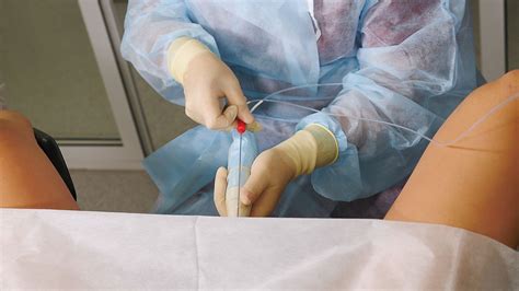 Intrauterine Insemination Iui Duniwh And Fertility