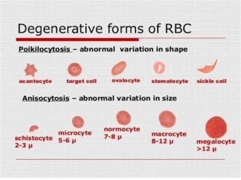 What Is The Difference Between Macrocytic And Megaloblastic Anaemia