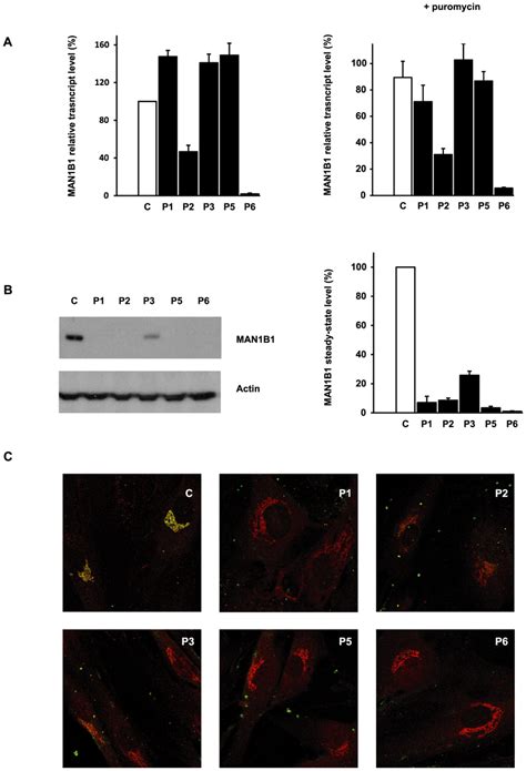 Functional Analyses Of Man1b1 Mutations A Quantification Of The