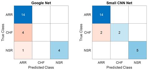Diagnostics Free Full Text Deep Learning Based Arrhythmia Detection