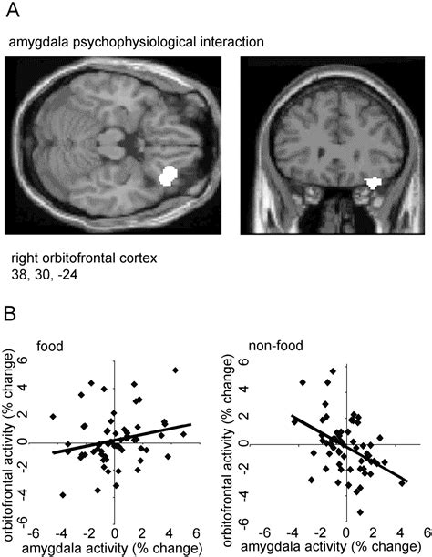 Involvement Of Human Amygdala And Orbitofrontal Cortex In Hunger