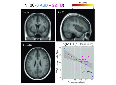 Correlations Of Functional Mri Fmri Activation [temporal Order
