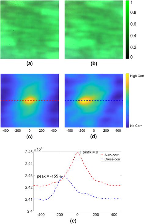 Intensity Based Laser Speckle Correlation In High Speed Scenario A
