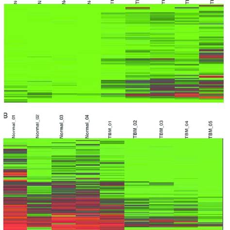 Heat Map Of Differentially Expressed Genes In Tbm Unsupervised