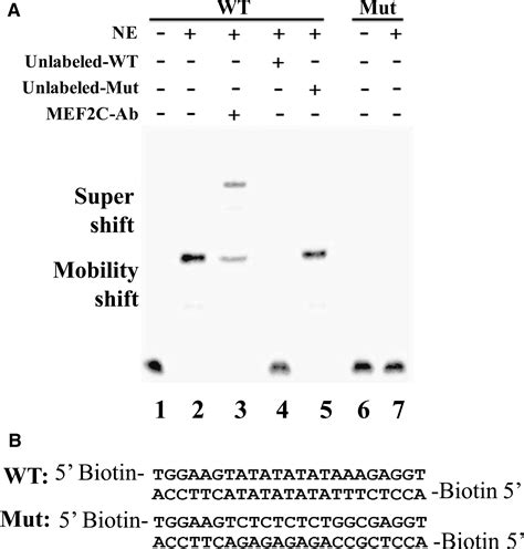 Rna Binding Protein Hur Regulates Scn5a Expression Through