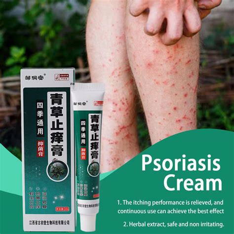 Psoriasis Cream Relief Itching Skin Antipruritic Cream Herbal