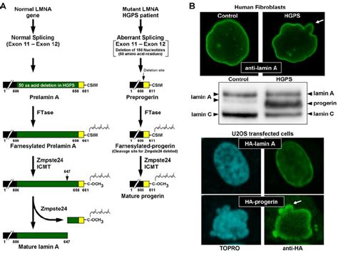 Defective Pre Lamin A Processing In Hgps And Nuclear Abnormalities