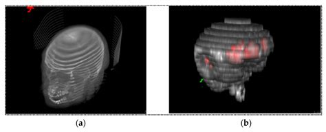 Diagnostics Free Full Text A Deep Learning Based Automatic