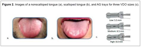 original article 1 issue 8 2 american academy of dental sleep medicine