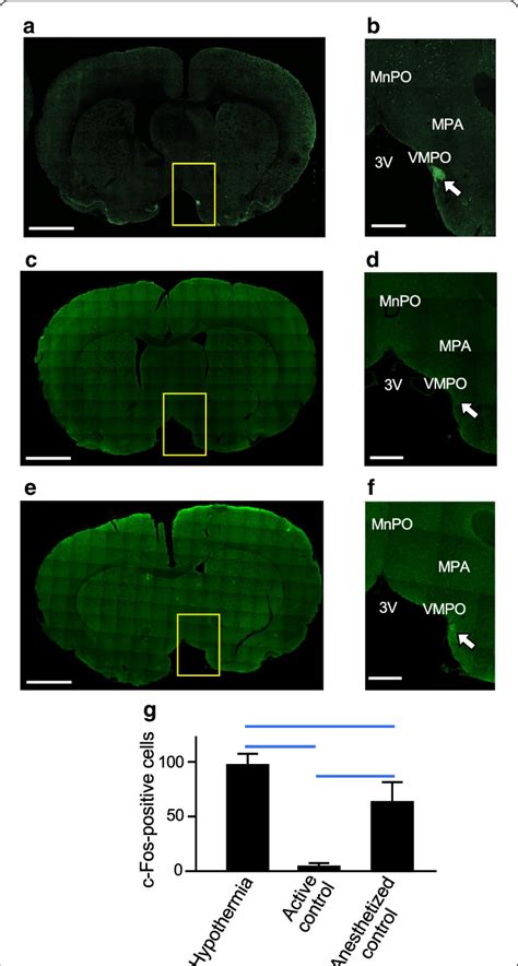 Immunohistochemistry For C Fos Protein In The Brain Representative