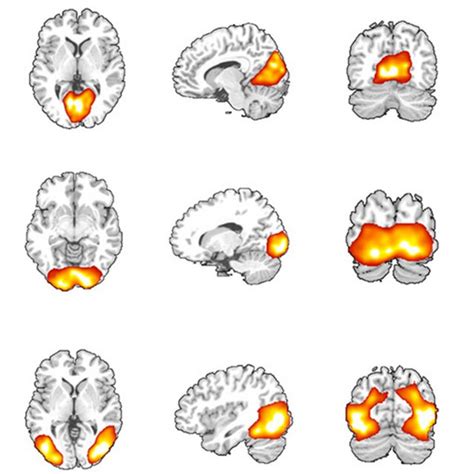Topography Of Visual Networks Estimated From The Resting State Fmri