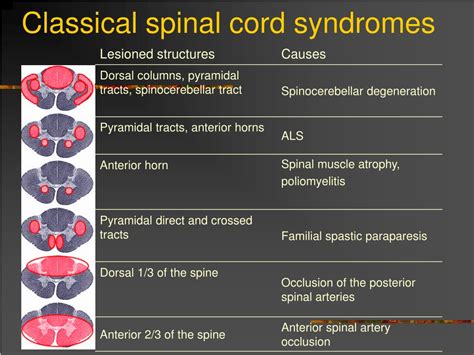 Ppt Spinal Chord Powerpoint Presentation Free Download Id 2287767