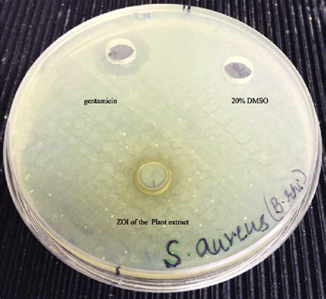 Zone Of Inhibition In Staphylococcus Aureus The Image Displays The Download Scientific Diagram