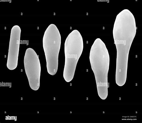 Scanning Electron Micrograph Sem Of Clostridium Spore Formation And