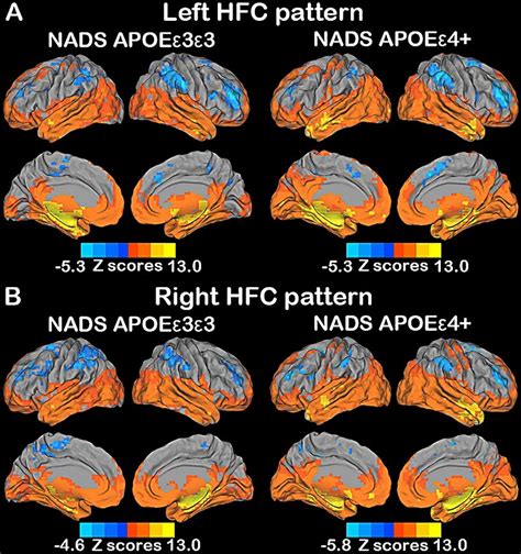 Bilateral Hippocampal Functional Connectivity Hfc Patterns In Each