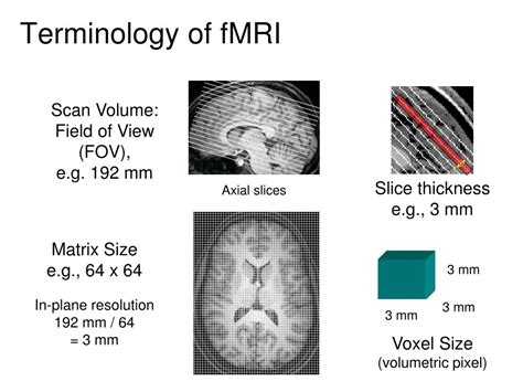 Ppt Spatial Preprocessing Powerpoint Presentation Free Download Id