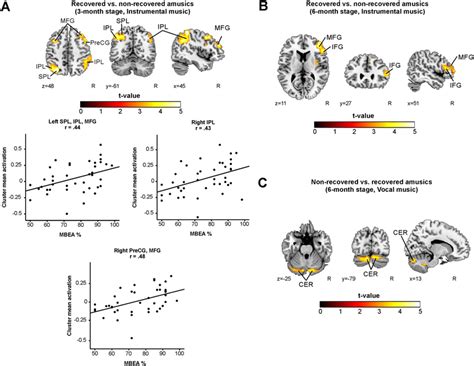 Fmri Activation Patterns During Music Listening A Comparison Between