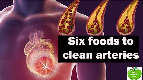 Six Foods To Clean Arteries Heart Healthy Foods Youtube