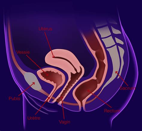Prolapsus Urolib