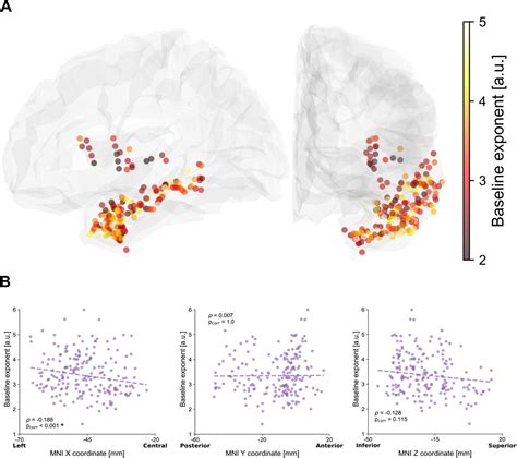 Intrinsic Neural Timescales In The Temporal Lobe Support An Auditory