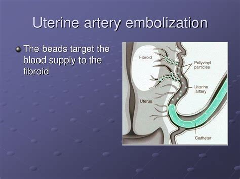 Uterine Artery Embolization