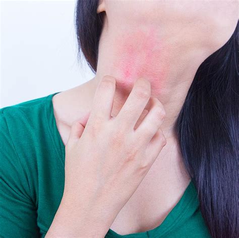 खुजली दूर करने के 15 आसान घरेलू उपाय Home Remedies For Itching