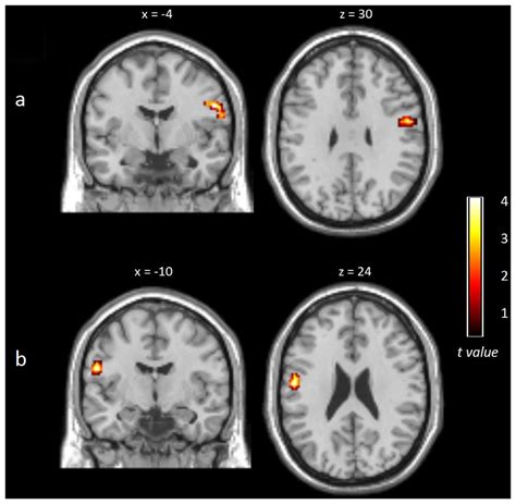 Figure S1 Spatial Maps Of Eight Resting State Networks Rsns