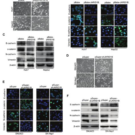 Jarid1b Regulates The Transition Between Epithelial And Mesenchymal