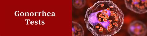 Gonorrhea Ulta Lab Tests