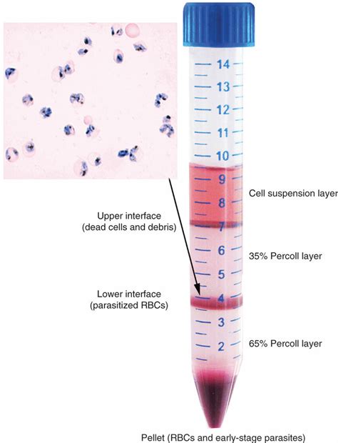 Percoll Density Gradient Centrifugation Procedure