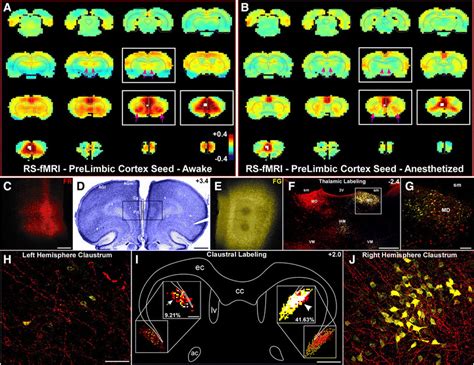 Rs Fmri In The Awake State Reveals Functional Connections Of The Mpfc