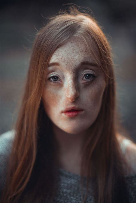 26 Year Old Born With Extremely Rare Facial Defect Is Breaking Beauty